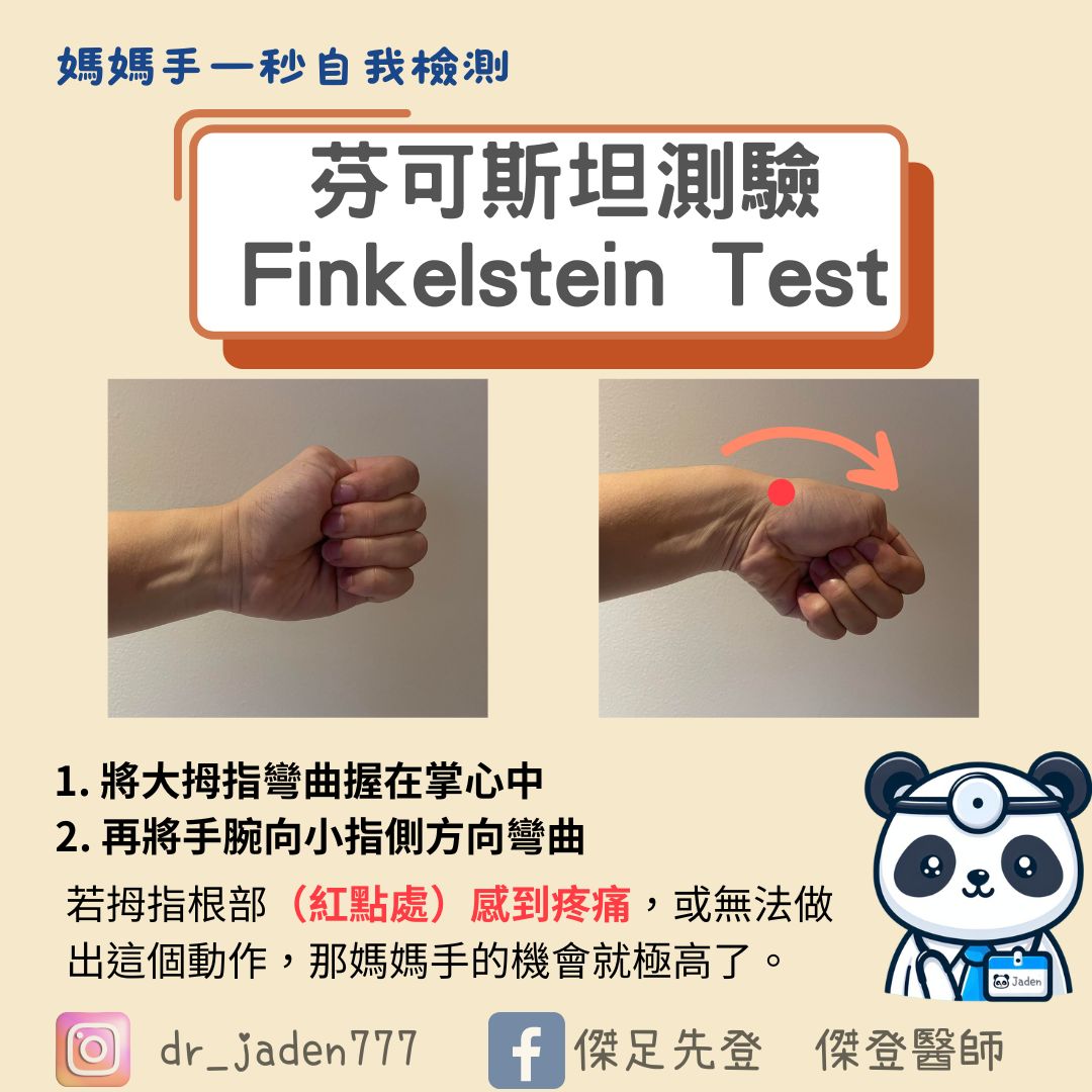 手腕莫名疼痛？教你一秒檢測「媽媽手」